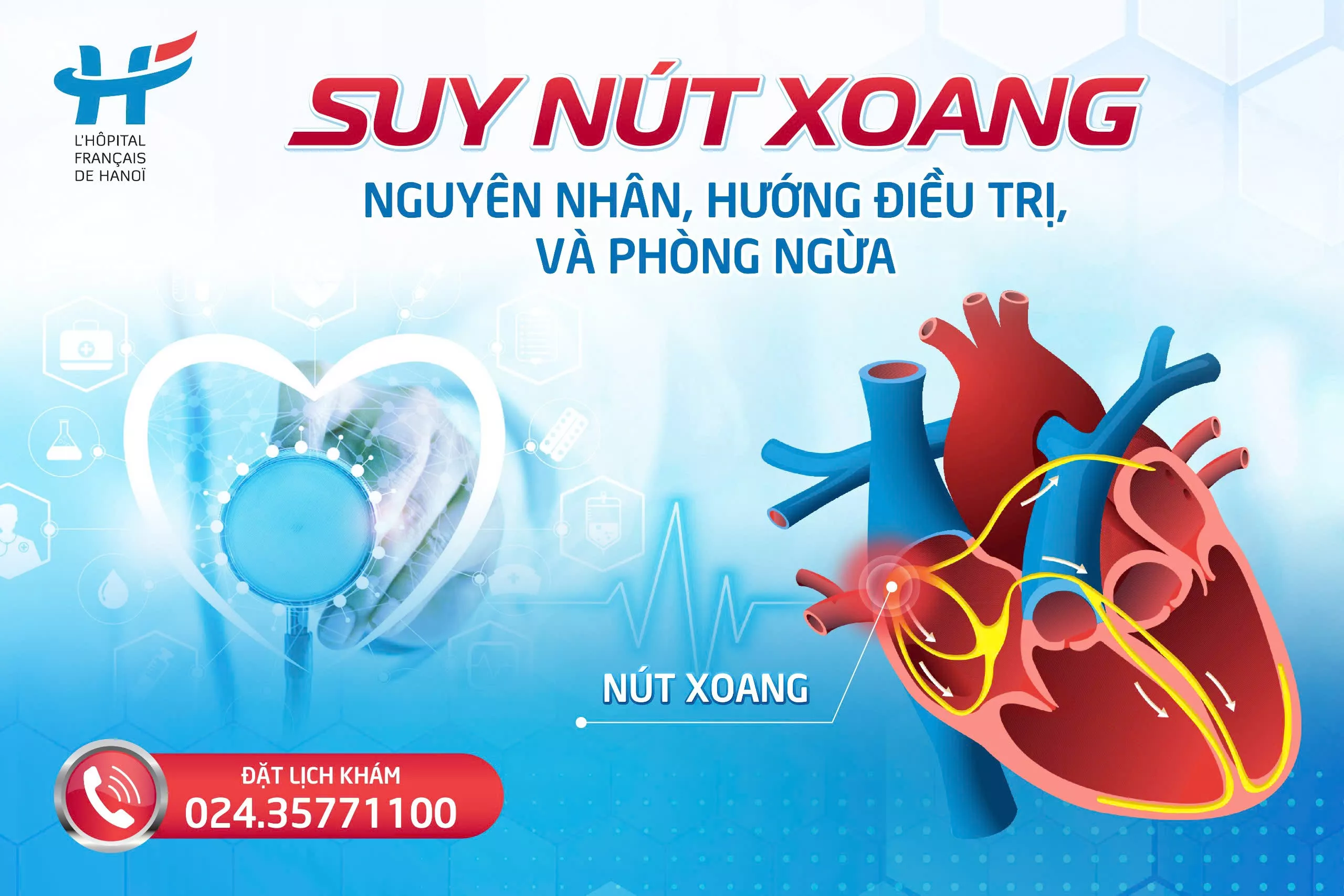 Sick Sinus Syndrome: Causes, Treatments and Preventions - Hôpital ...