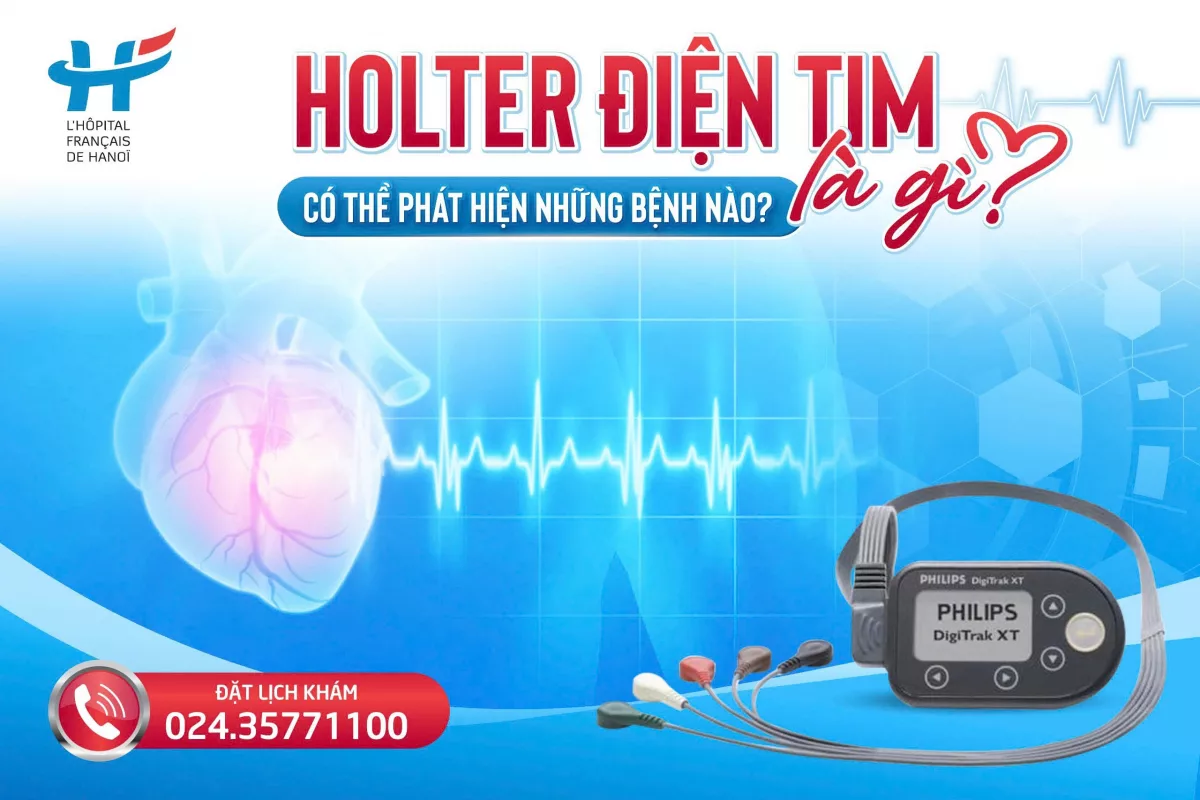 HOLTER ĐIỆN TIM ĐƯỢC CHỈ ĐỊNH KHI NÀO? - Bệnh Viện Việt Pháp Hà Nội
